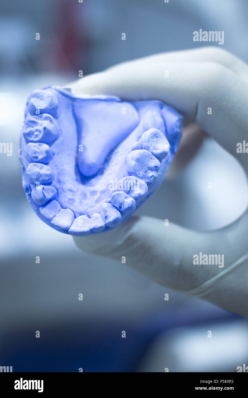 Dental mold dentist clay teeth plate ceramic cast model showing tooth ...