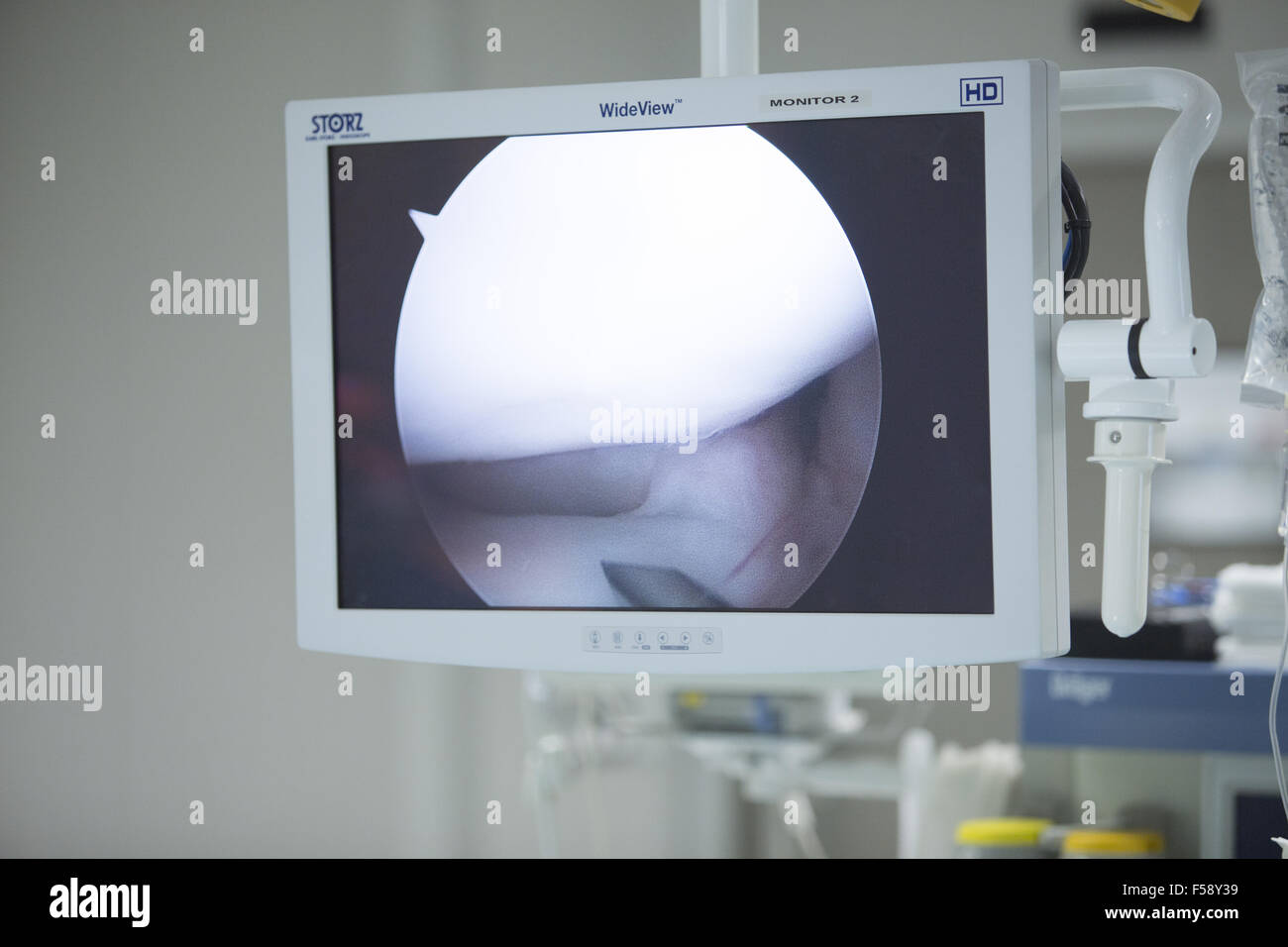 Traumatology orthopedic surgery hospital emergency operating room ...