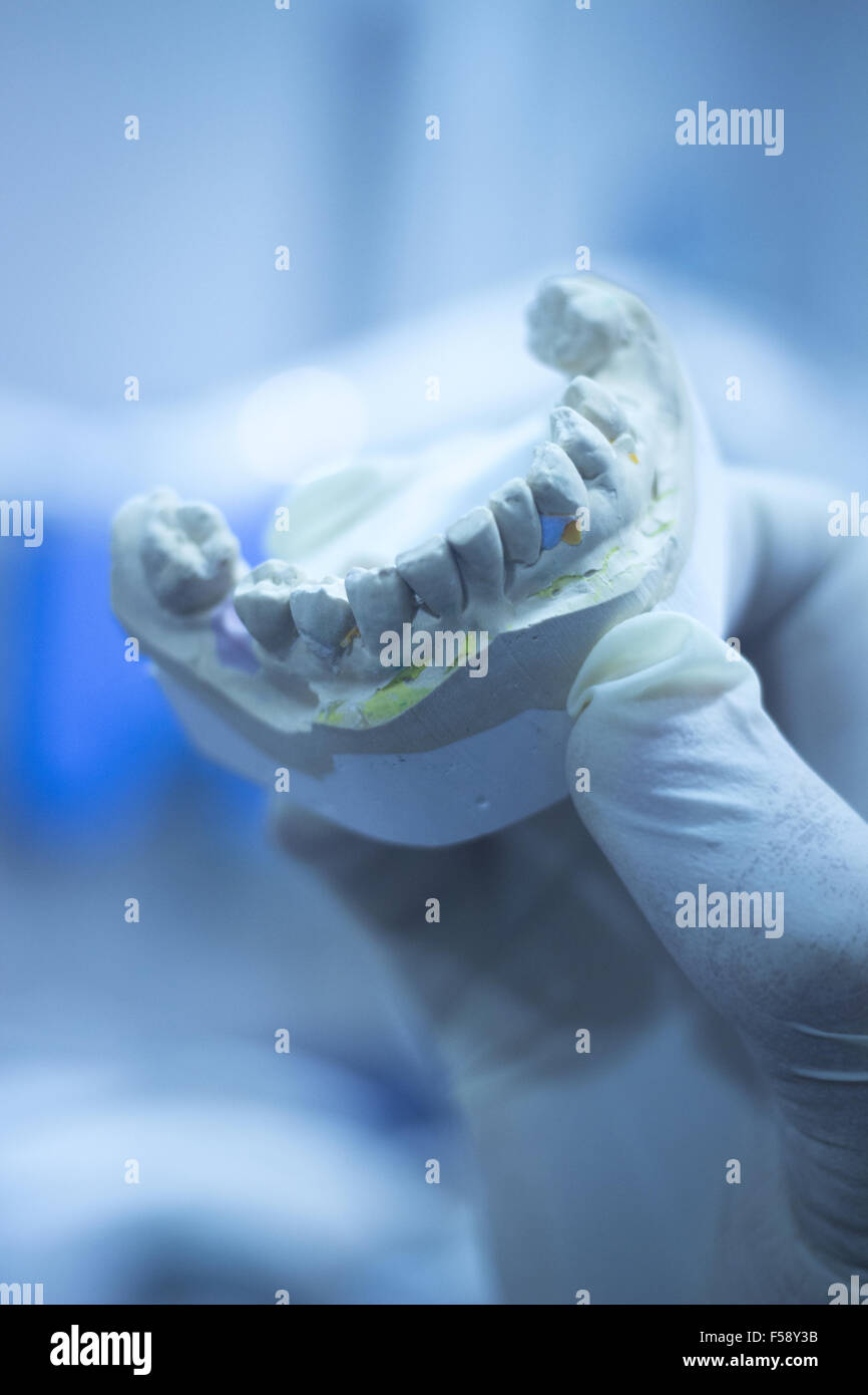 Dental mold dentist clay teeth plate ceramic cast model showing tooth ...