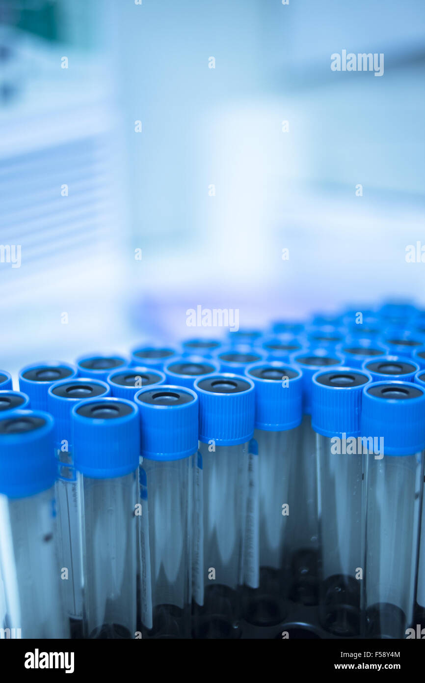 Medical laboratory preparation of human growth factors PRP platelet ...