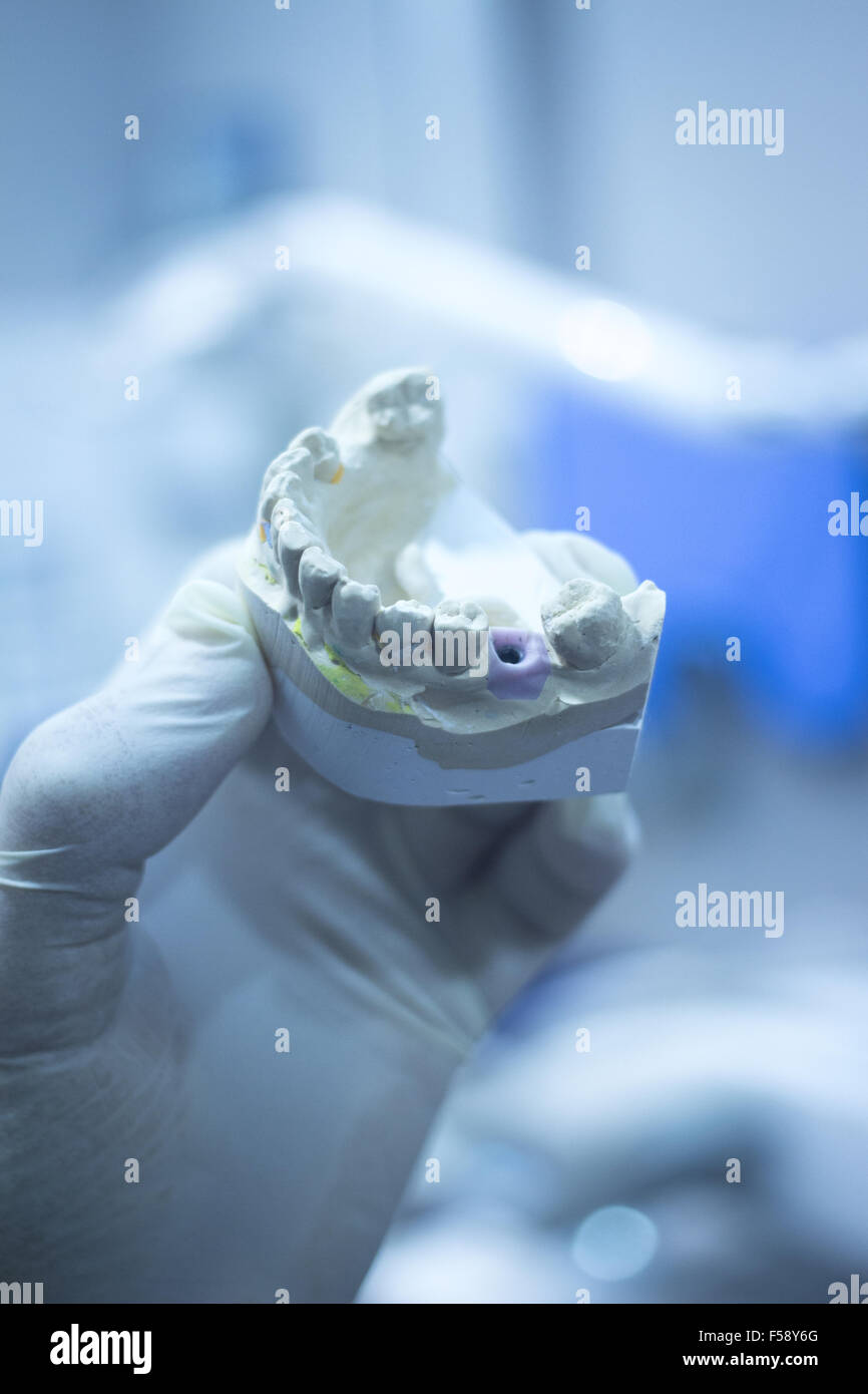 Dental mold dentist clay teeth plate ceramic cast model showing tooth ...