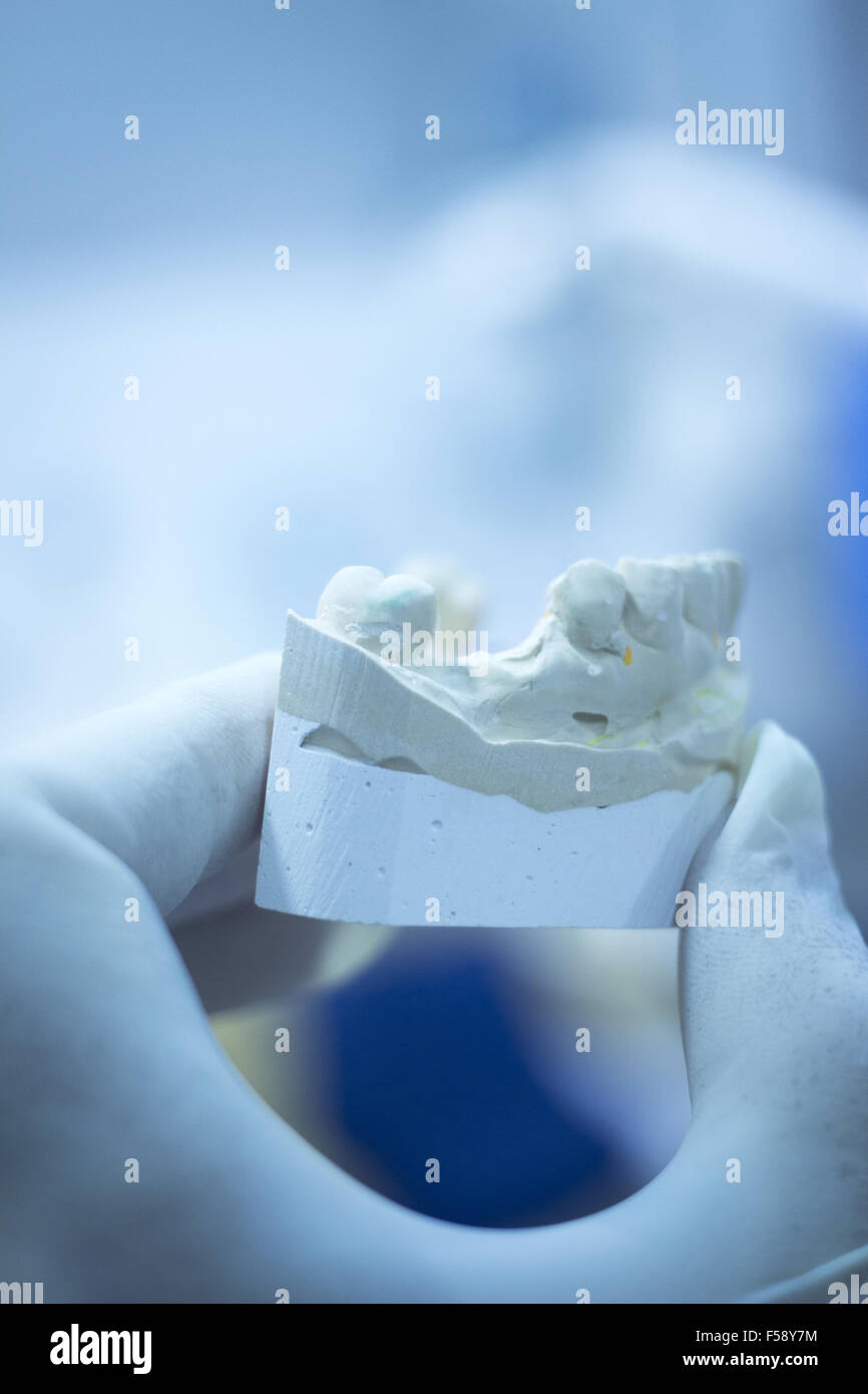 Dental mold dentist clay teeth plate ceramic cast model showing tooth ...