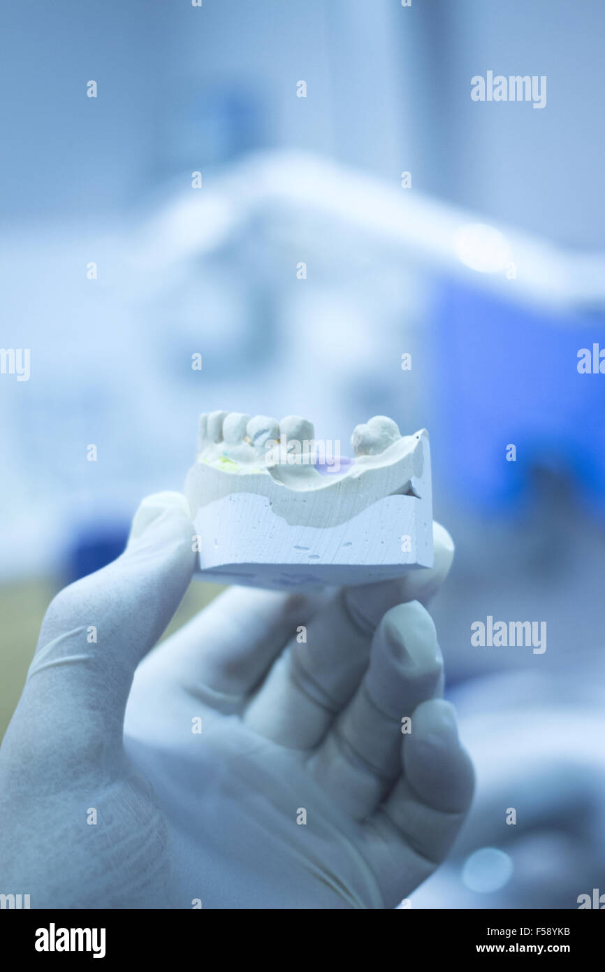 Dental mold dentist clay teeth plate ceramic cast model showing tooth ...