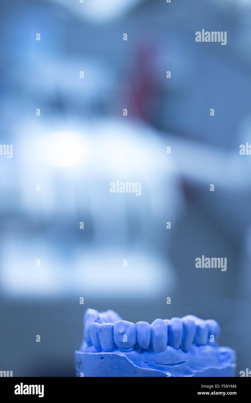 Dental mold dentist clay teeth plate ceramic cast model showing tooth ...