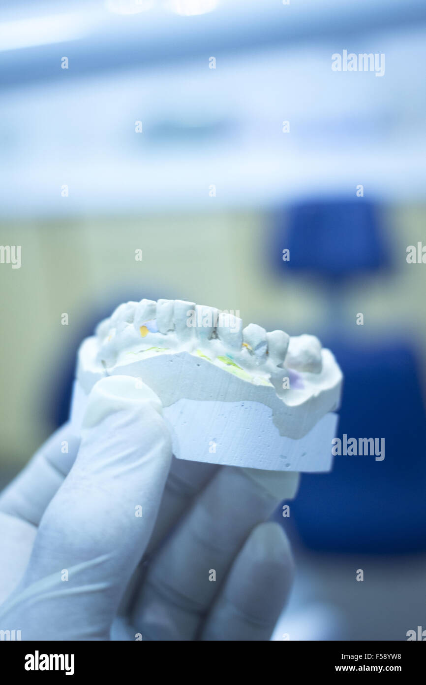 Dental mold dentist clay teeth plate ceramic cast model showing tooth ...