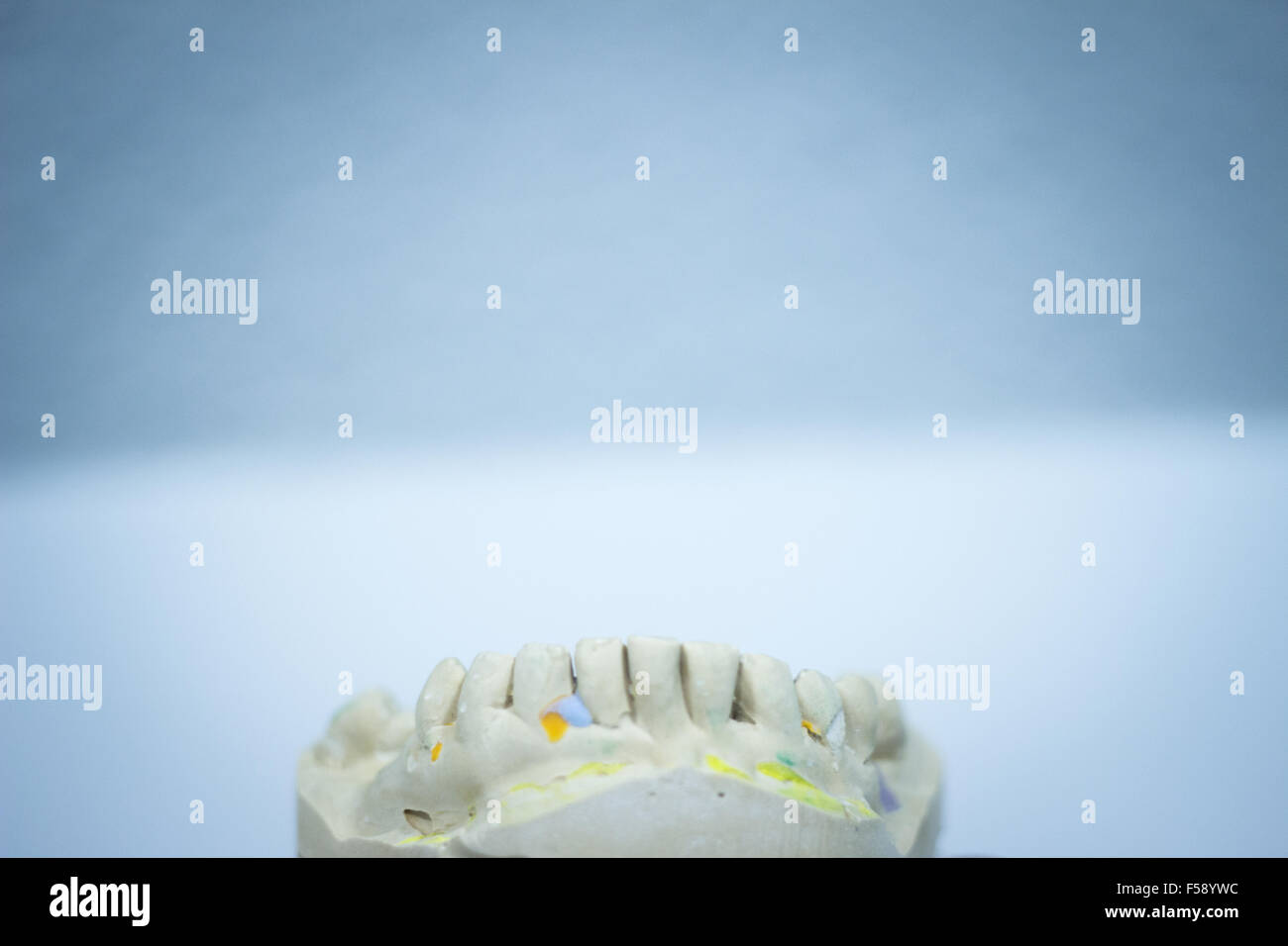 Dental mold dentist clay teeth plate ceramic cast model showing tooth ...