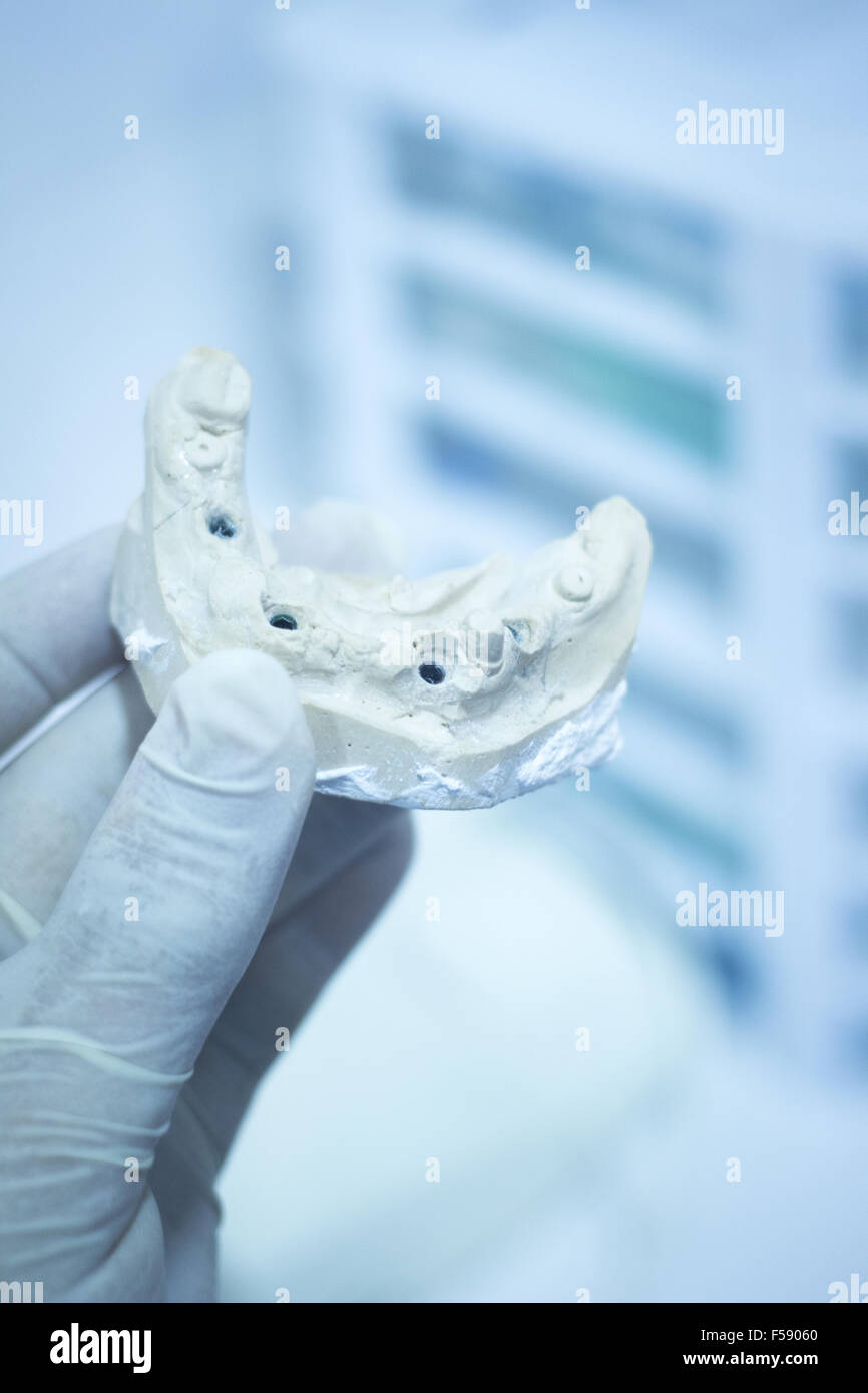 Dental mold dentist clay teeth plate ceramic cast model showing tooth ...