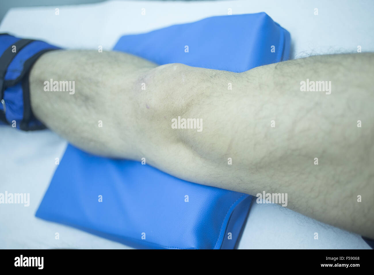Leg of injured man in physiotherapy treatment in hospital clinic Stock ...