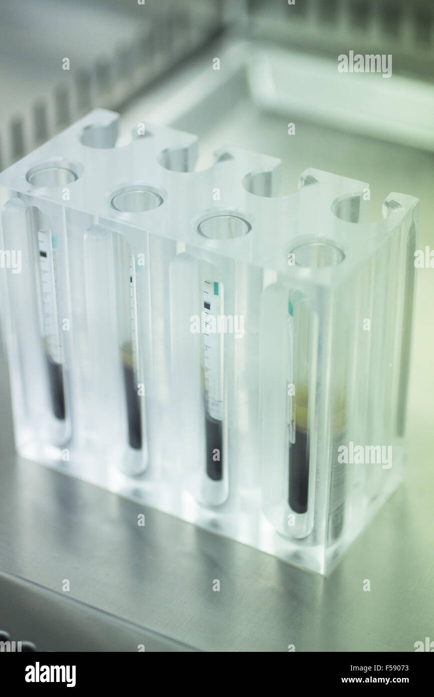 Medical laboratory preparation of human growth factors in hospital ...