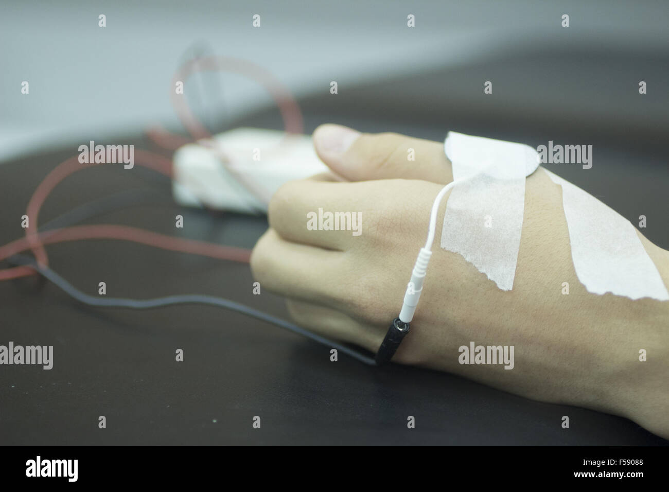 Color photo of a the hand of a young man in physiotherapy rehabiliation ...