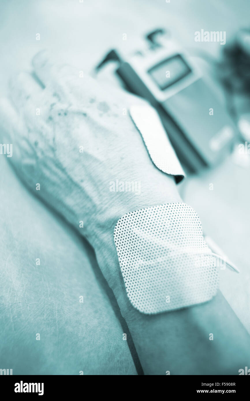 Patient hand, wrist and arm in electro physiotherapy electrical impulse ...
