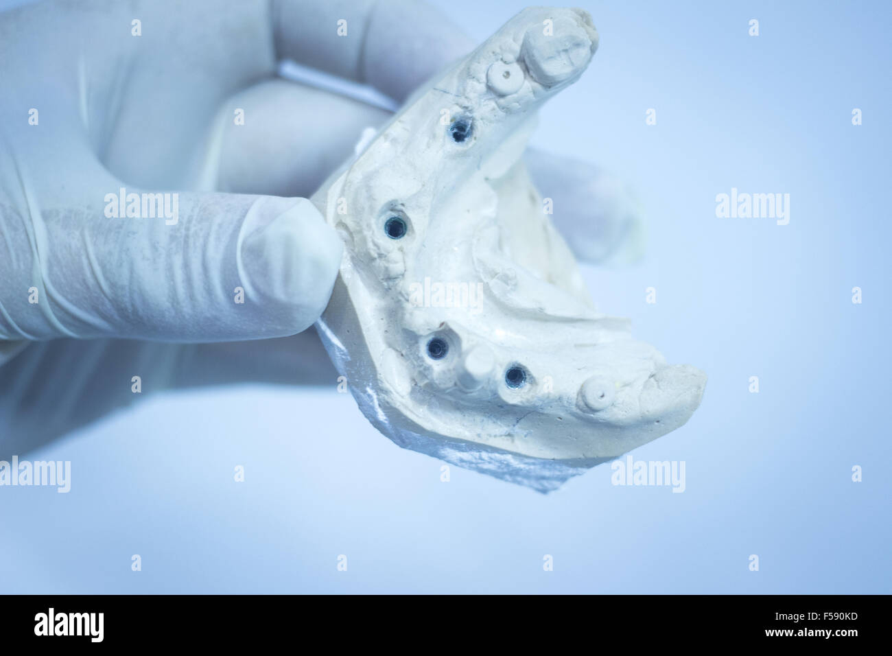 Dental mold dentist clay teeth plate ceramic cast model showing tooth ...