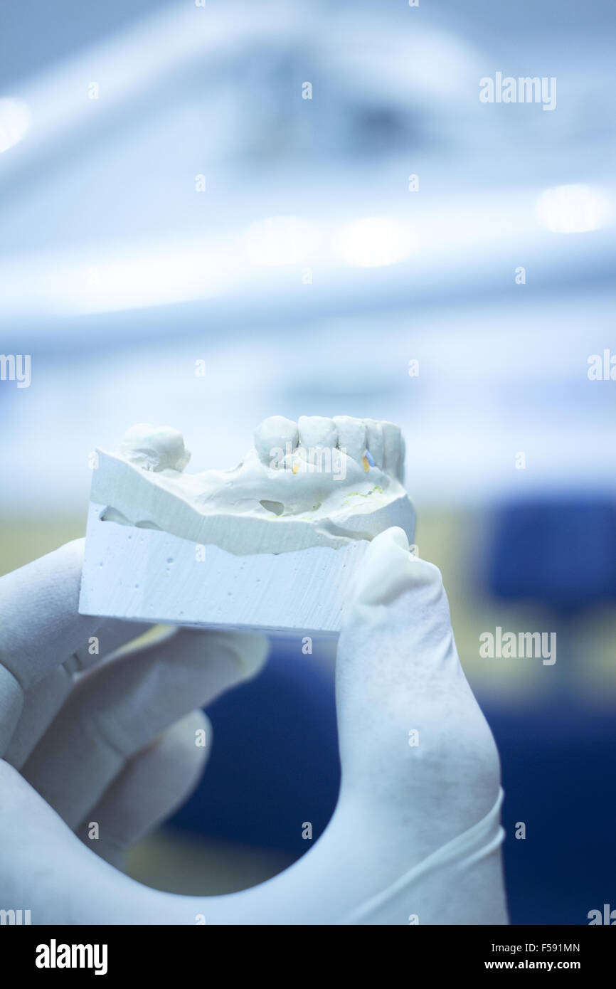 Dental mold dentist clay teeth plate ceramic cast model showing tooth ...