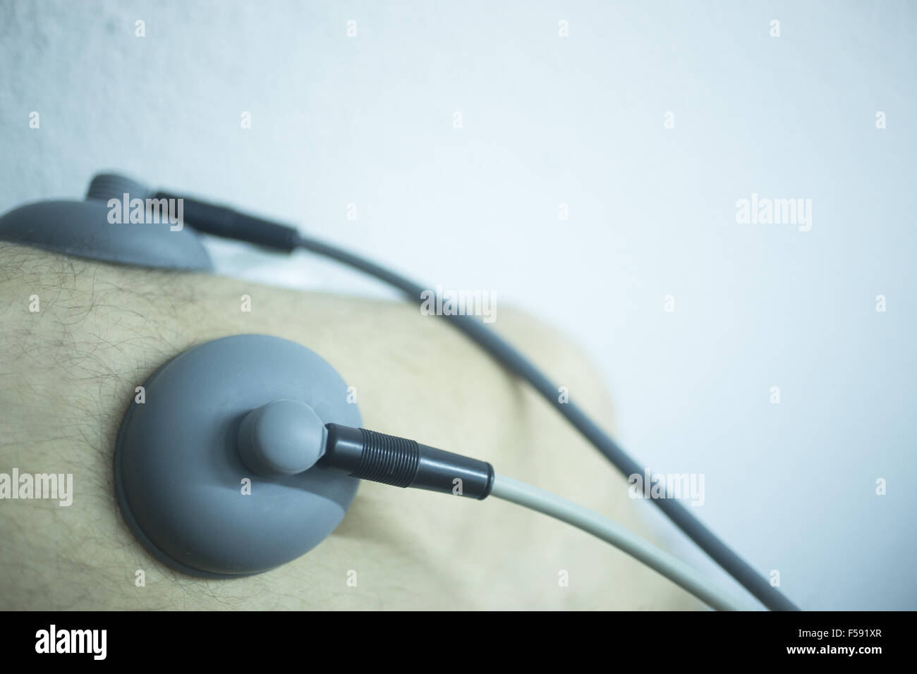 Electro stimulation used to treat pain in hospital physiotherapy clinic ...