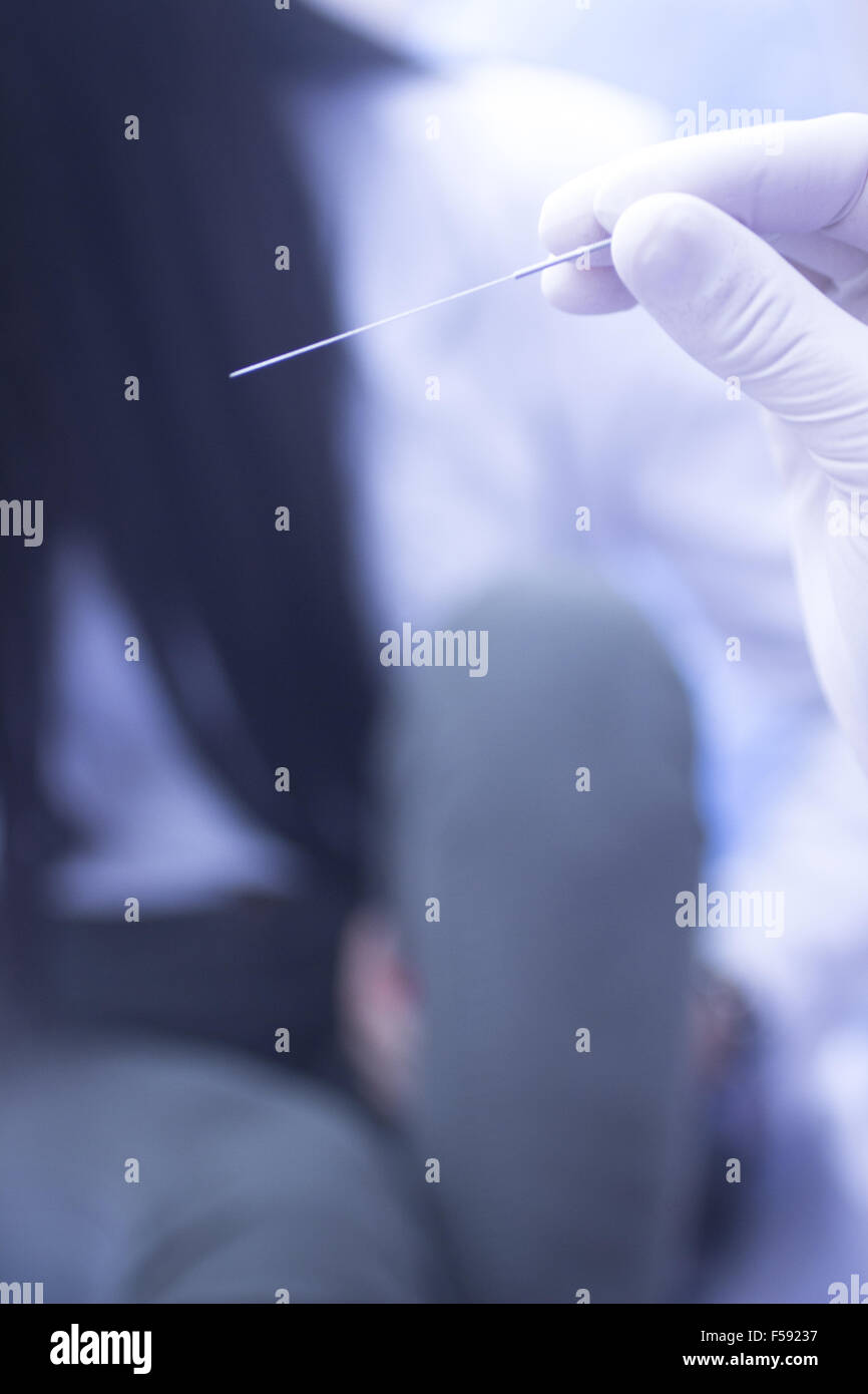 Doctor hand acupuncture needle young female patient arm real life photo ...