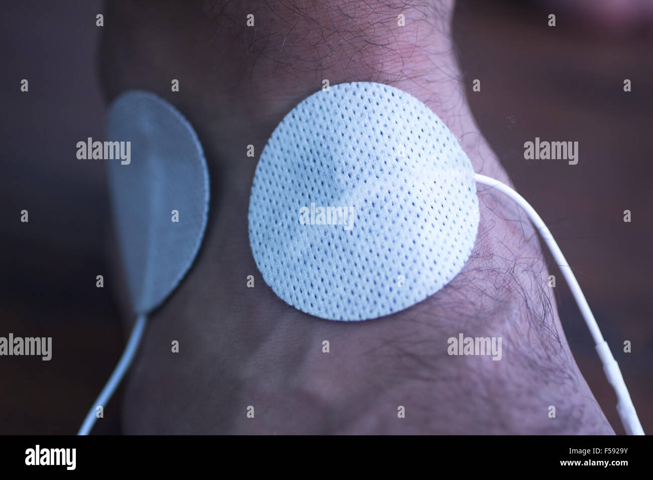 Patient hand arm wrist in electro physiotherapy electrical impulse ...