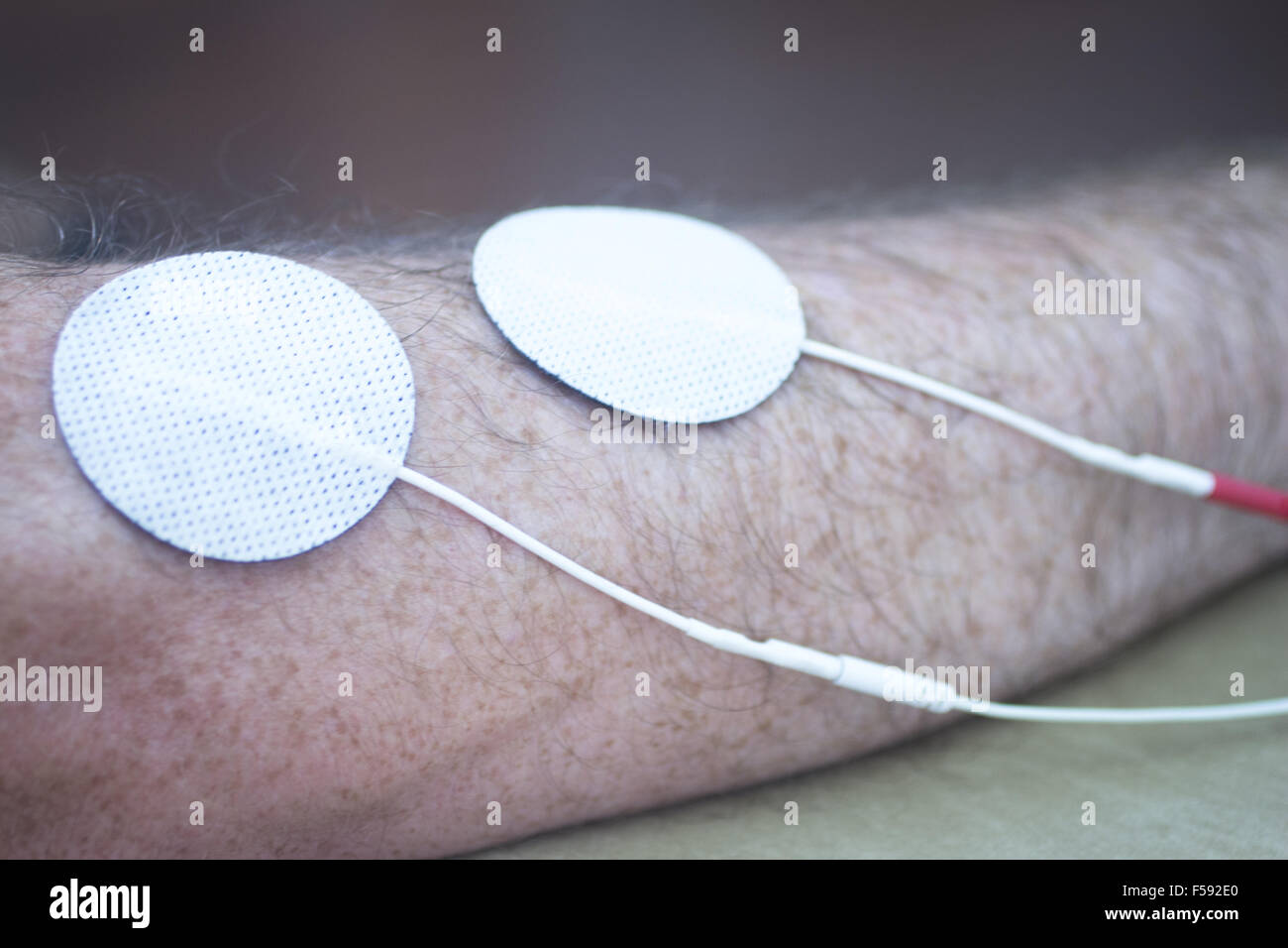 Patient hand arm wrist in electro physiotherapy electrical impulse ...