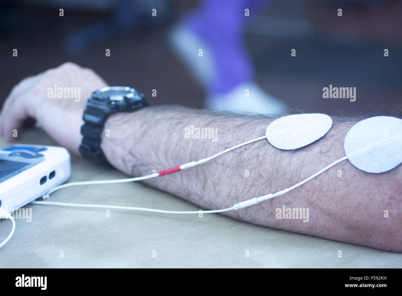 Patient hand arm wrist in electro physiotherapy electrical impulse ...