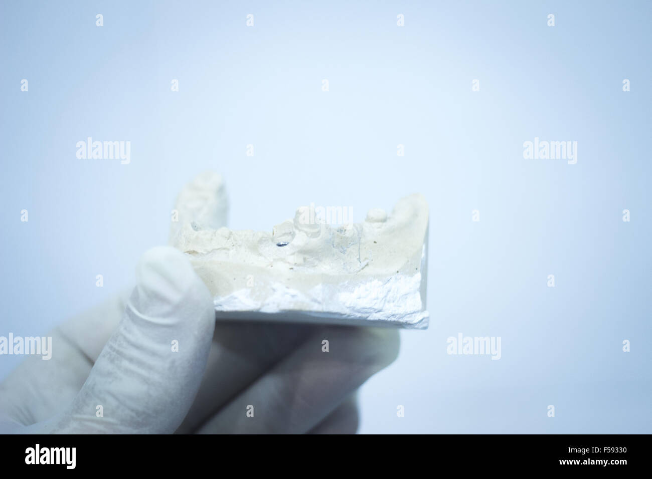 Dental mold dentist clay teeth plate ceramic cast model showing tooth ...