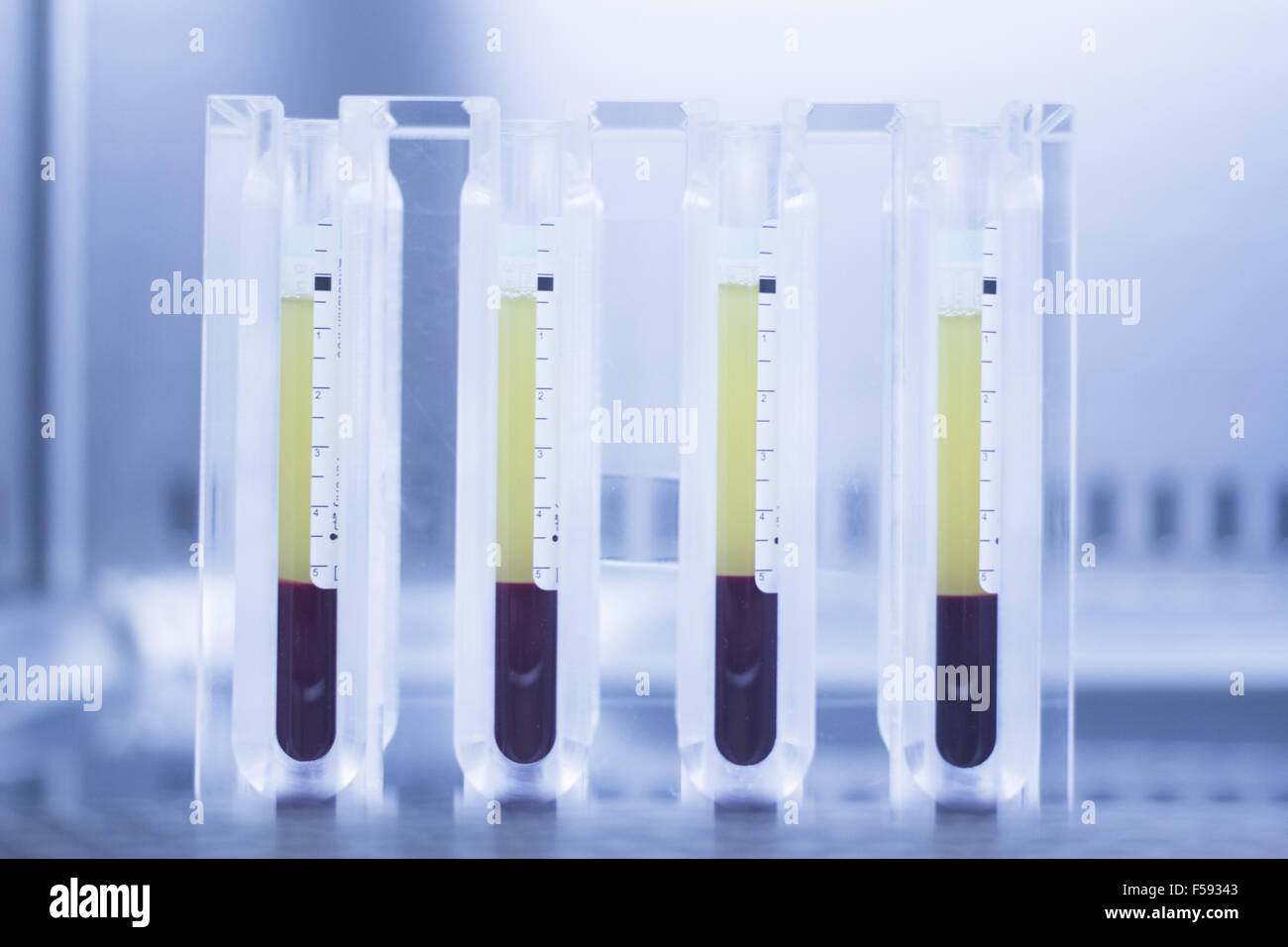 Medical laboratory preparation of human growth factors PRP platelet ...
