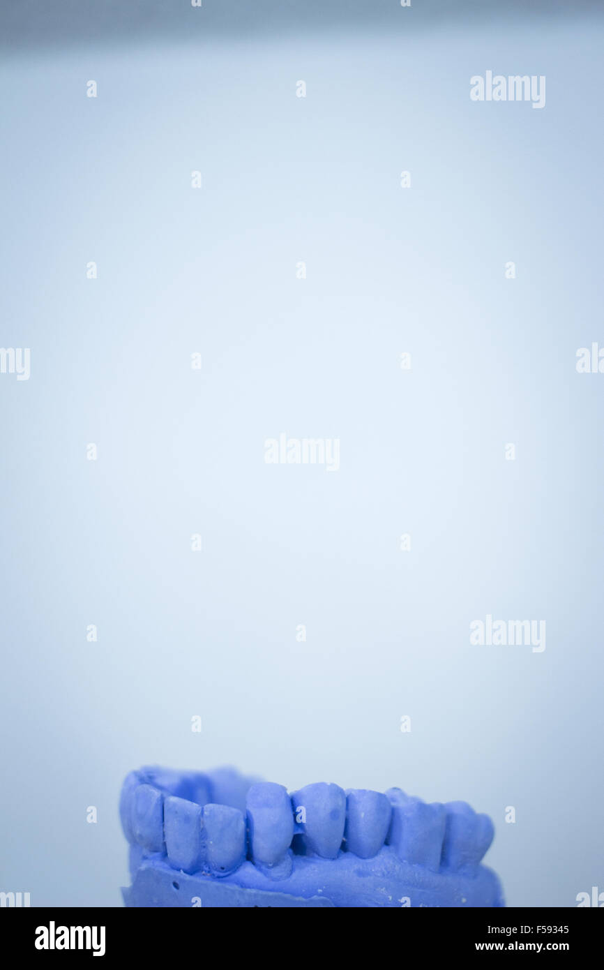 Dental mold dentist clay teeth plate ceramic cast model showing tooth ...