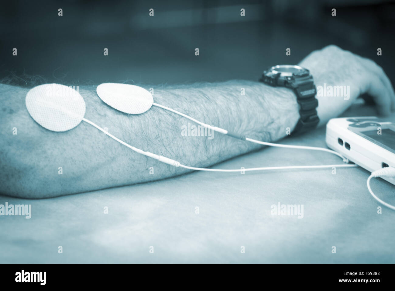 Patient hand arm wrist in electro physiotherapy electrical impulse ...