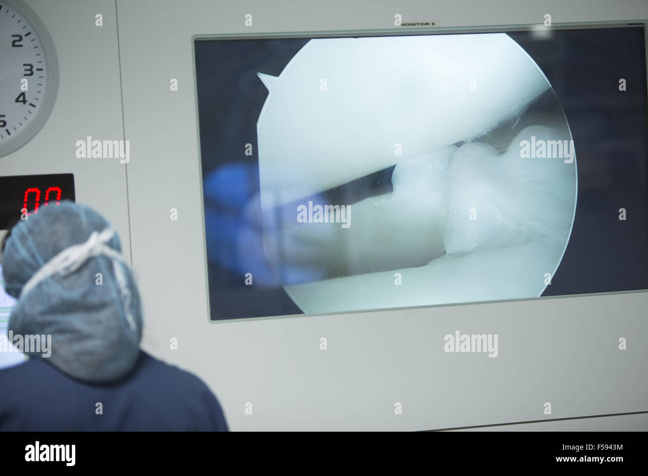 Traumatology orthopedic surgery hospital emergency operating room ...