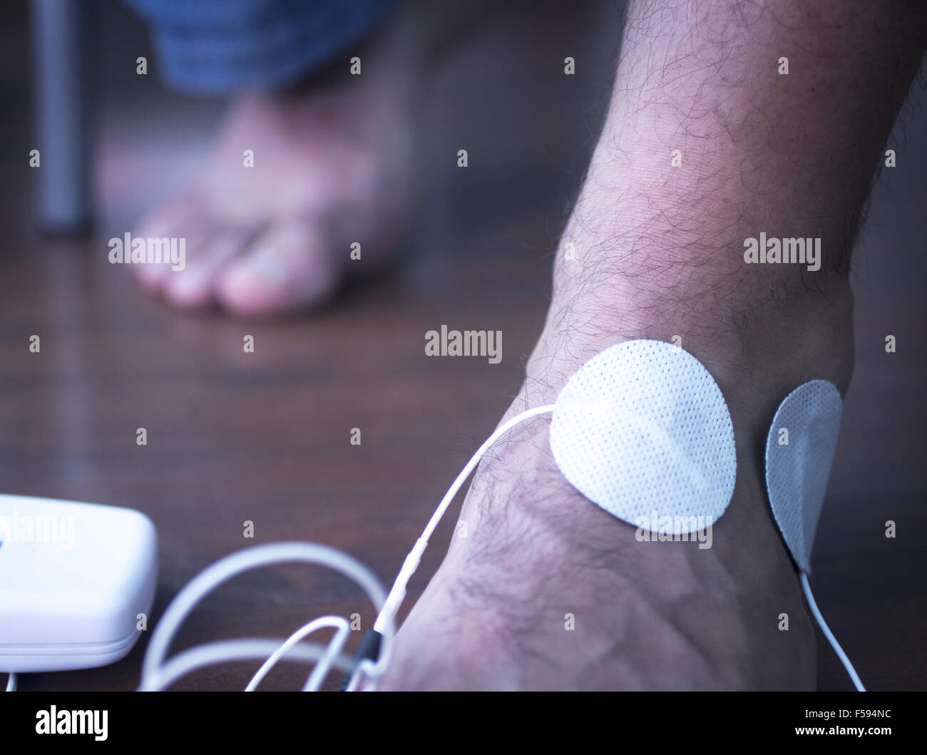 Patient hand arm wrist in electro physiotherapy electrical impulse ...