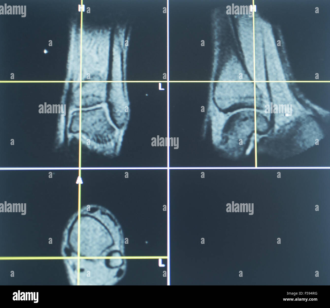 Examination of X-ray MRI CT on computer screen Stock Photo - Alamy