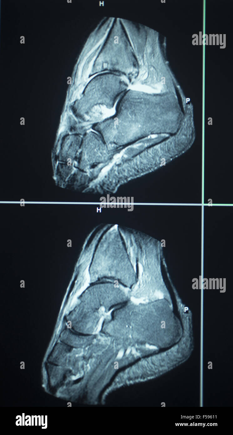 Mri magentic resonance imaging nuclear hi-res stock photography and ...