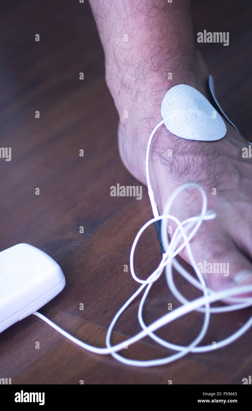 Patient hand arm wrist in electro physiotherapy electrical impulse ...