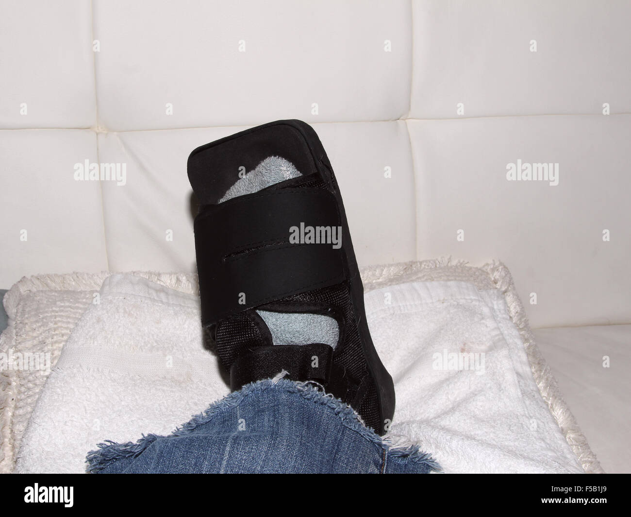 Foot after Morton’s neuroma surgery between the second and third toe ...