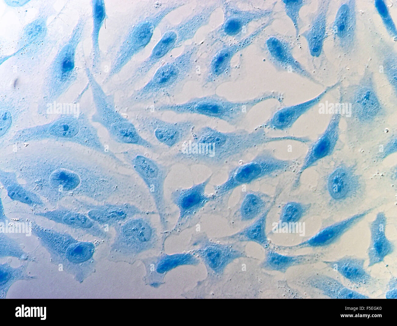 HeLa cervical cancer cells, stained with Coomassie blue, under ...