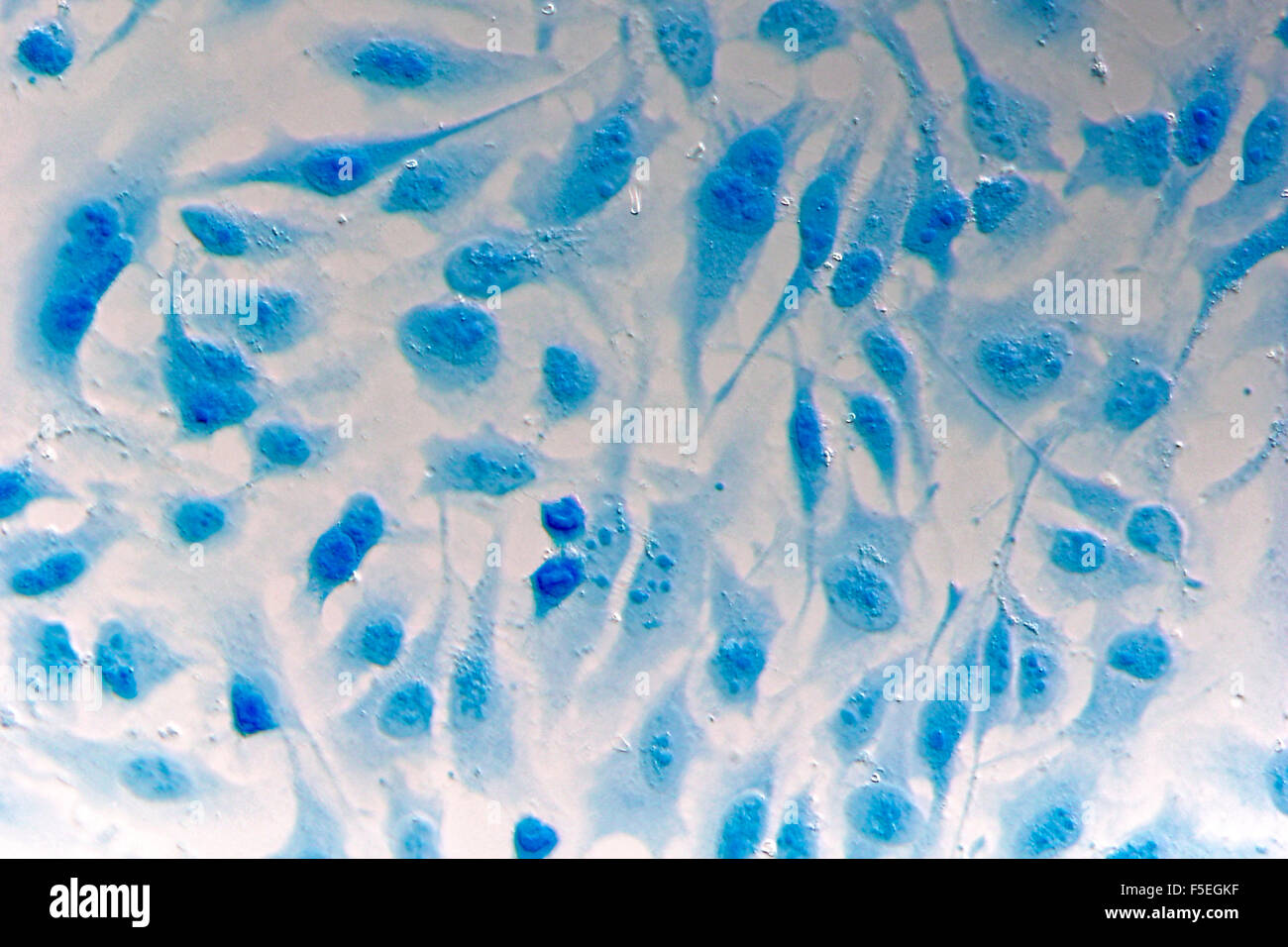 HeLa cervical cancer cells, stained with Coomassie blue, under ...