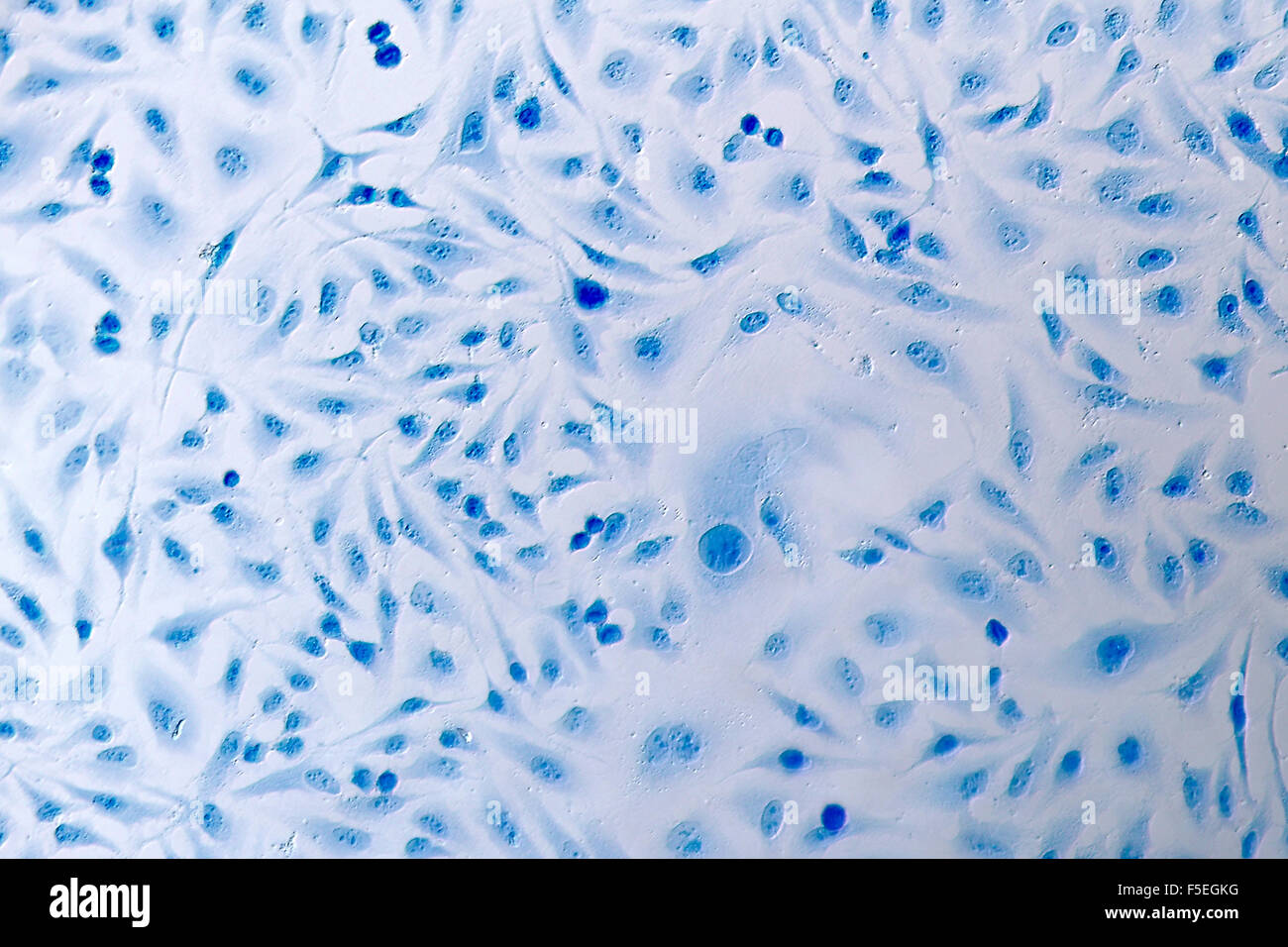 HeLa cervical cancer cells, stained with Coomassie blue, under ...