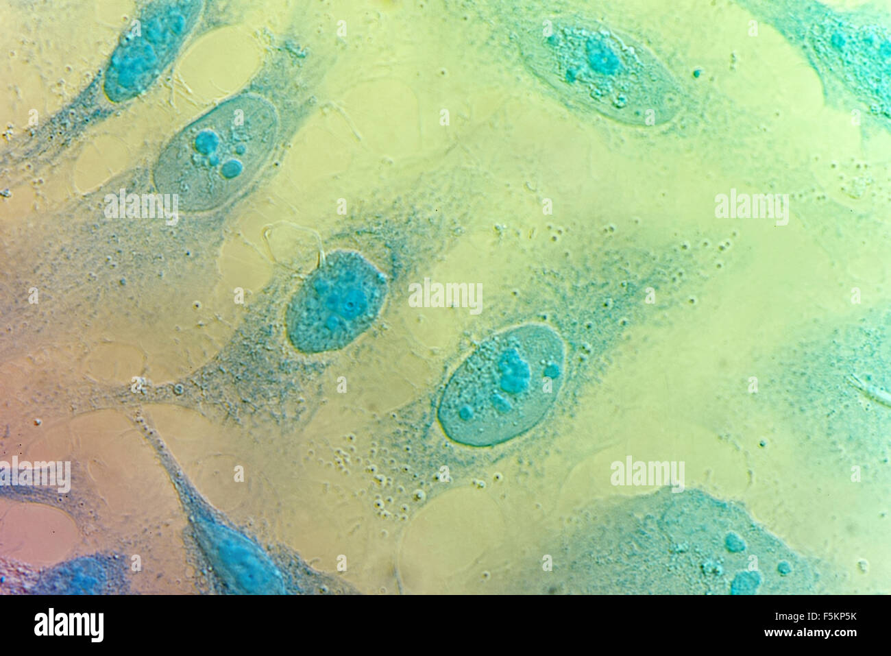 HeLa cervical cancer cells, stained with Coomassie blue, under ...