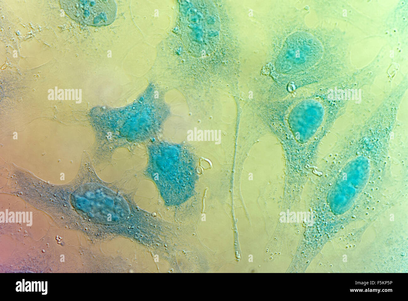 HeLa cervical cancer cells, stained with Coomassie blue, under ...