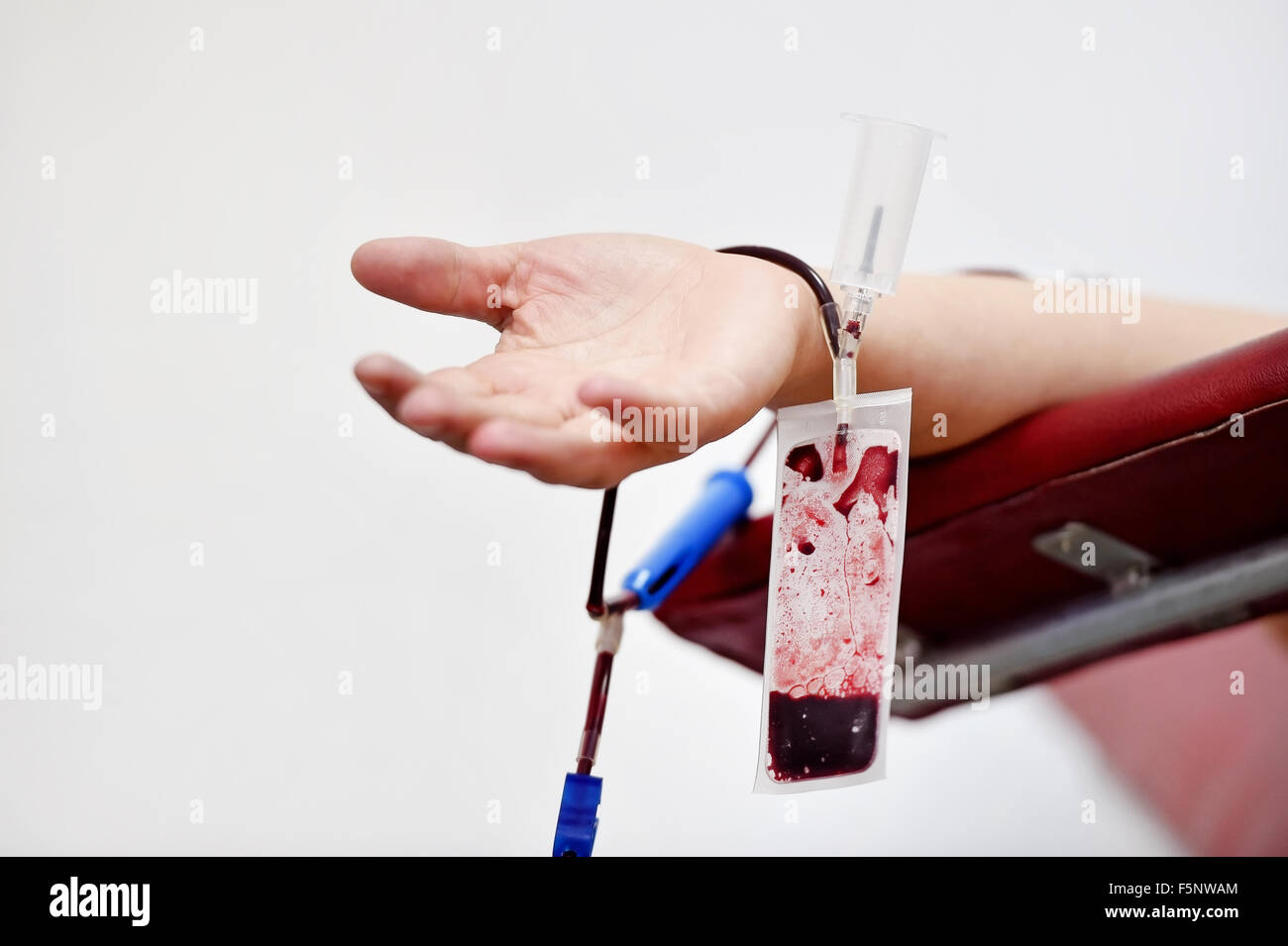 Detail with the hand of a blood donor and a plastic blood bag in a ...