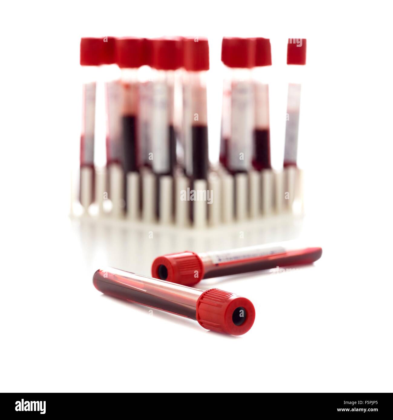 Blood collection tubes against a white background Stock Photo - Alamy