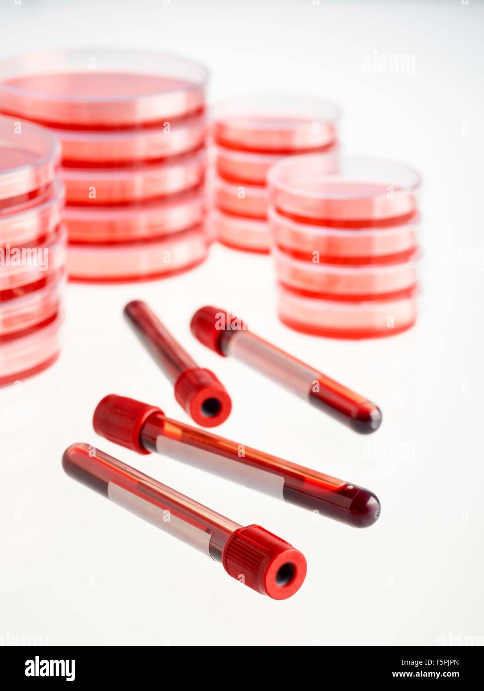 Blood collection tubes and petri dishes against a white background ...