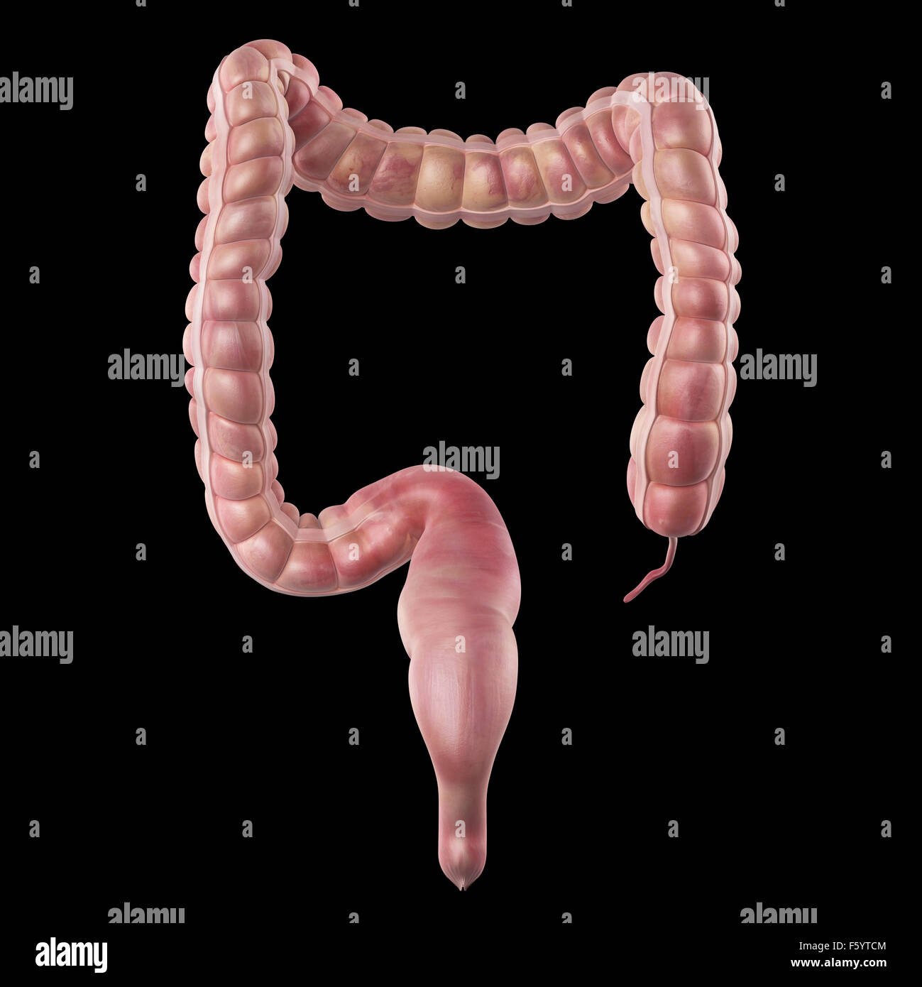 medically accurate illustration of the colon Stock Photo - Alamy
