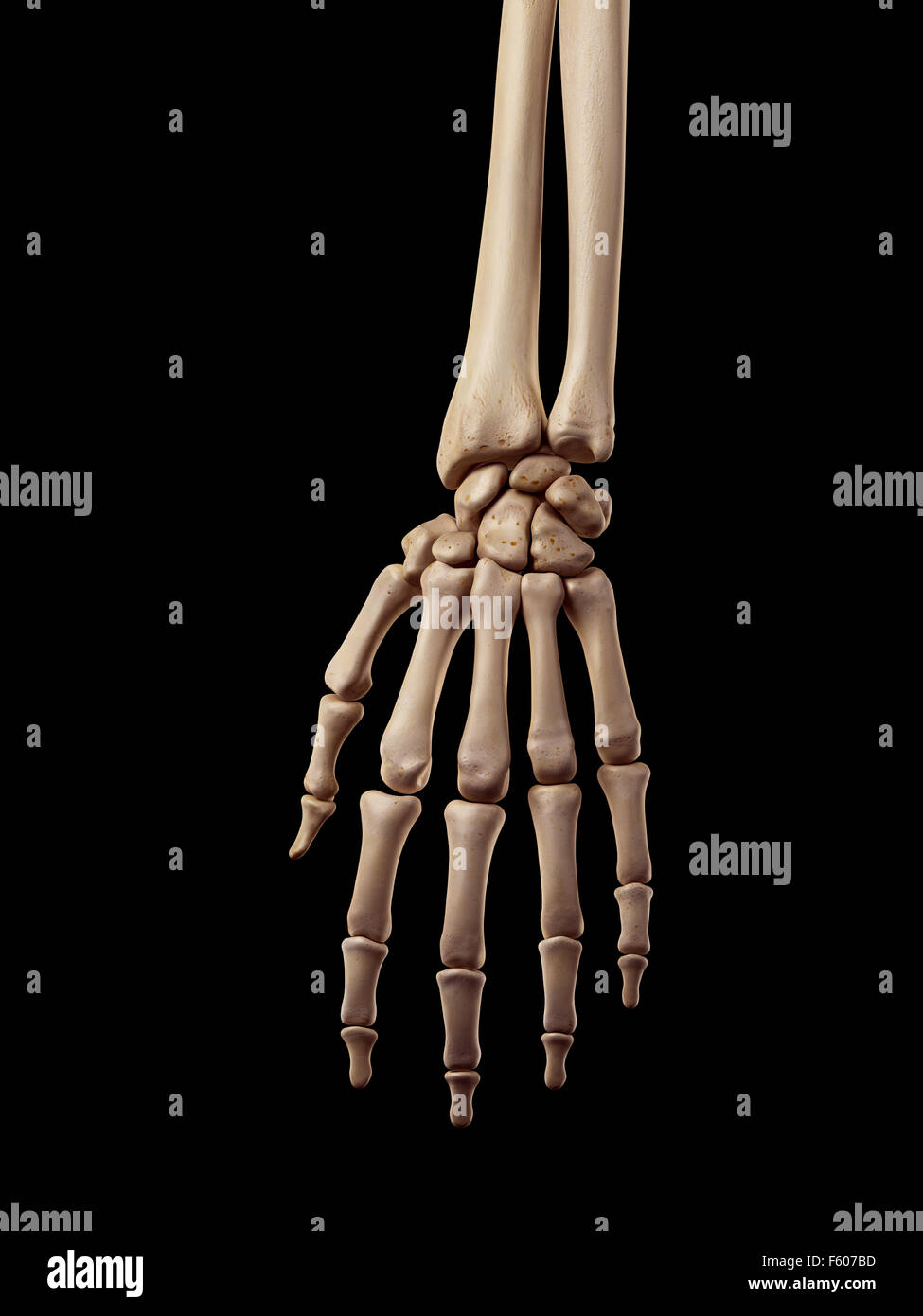 Hand And Wrist Bones Photograph By Science Source