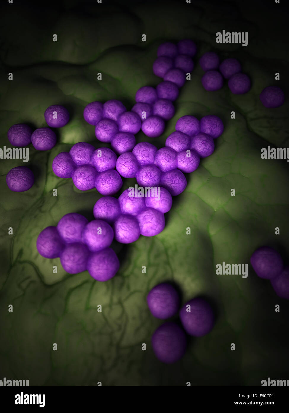 Mrsa hi-res stock photography and images - Alamy