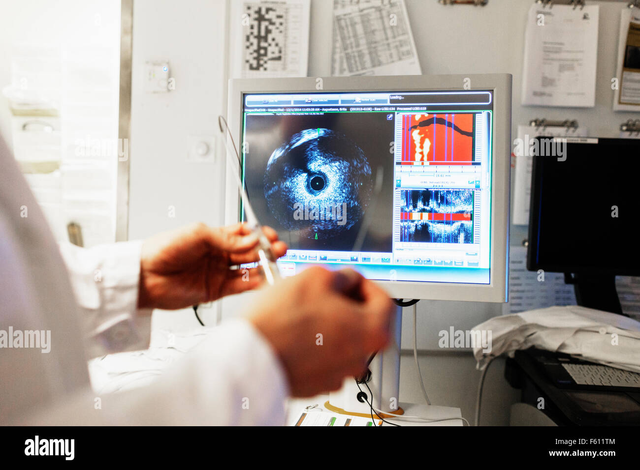 Intravascular ultrasound hi-res stock photography and images - Alamy