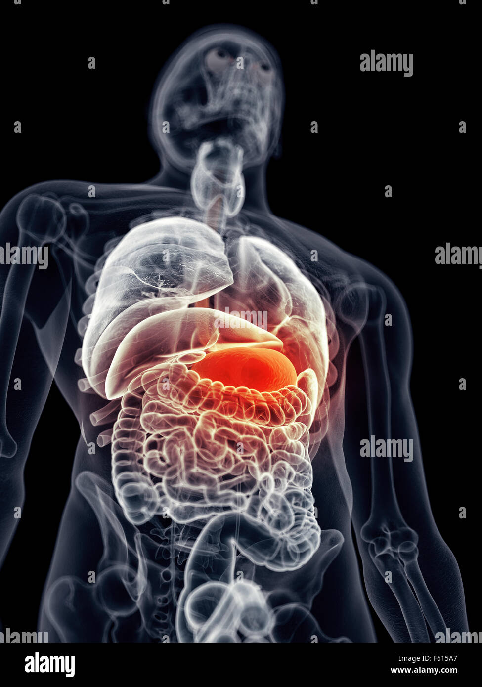 medically accurate illustration - painful stomach Stock Photo - Alamy