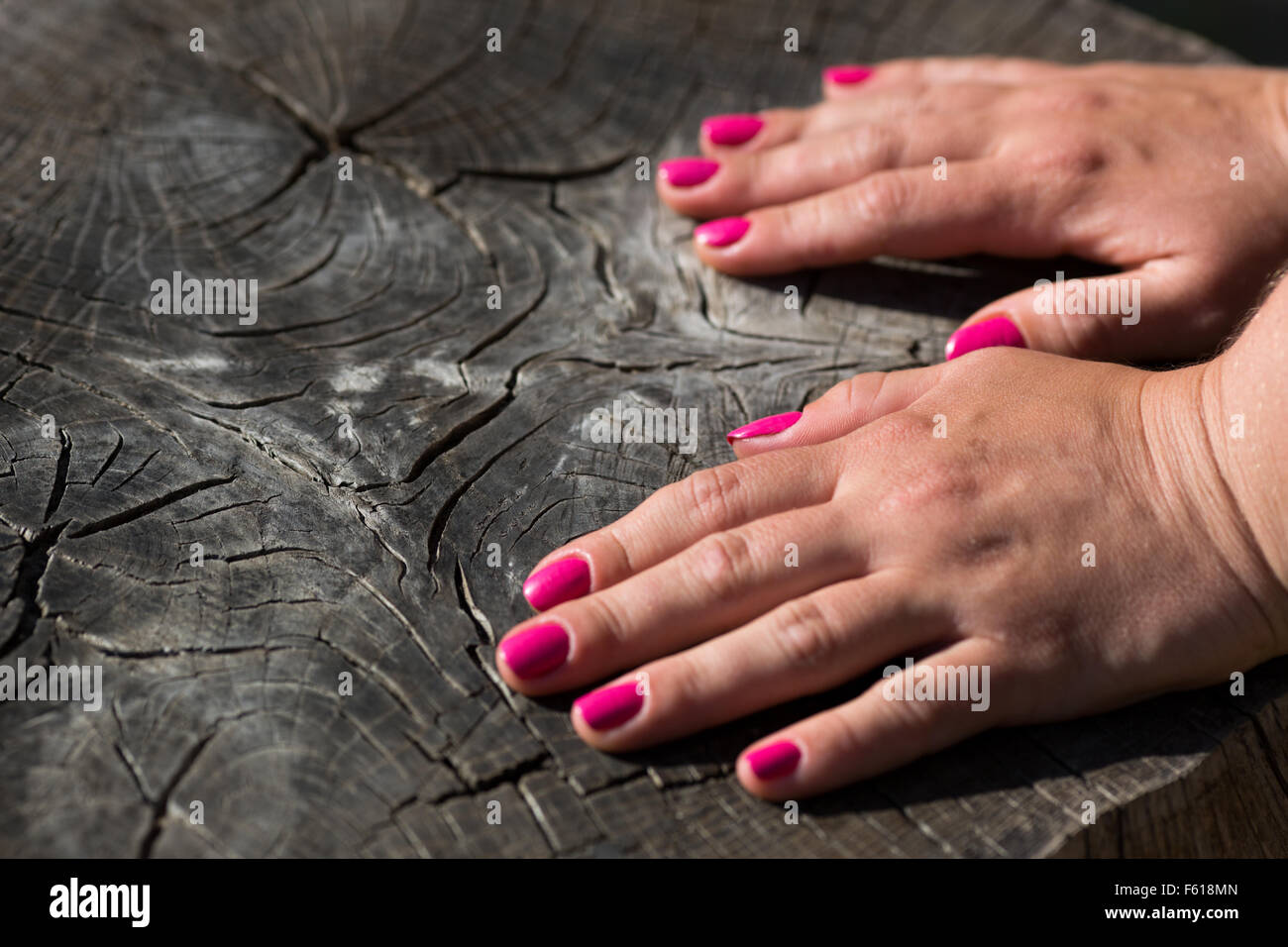 Hand stump hi-res stock photography and images - Alamy