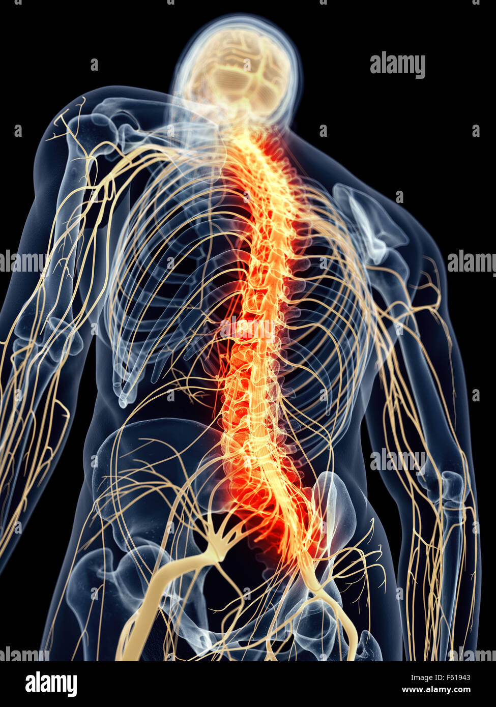 medically accurate illustration - painful spine Stock Photo - Alamy