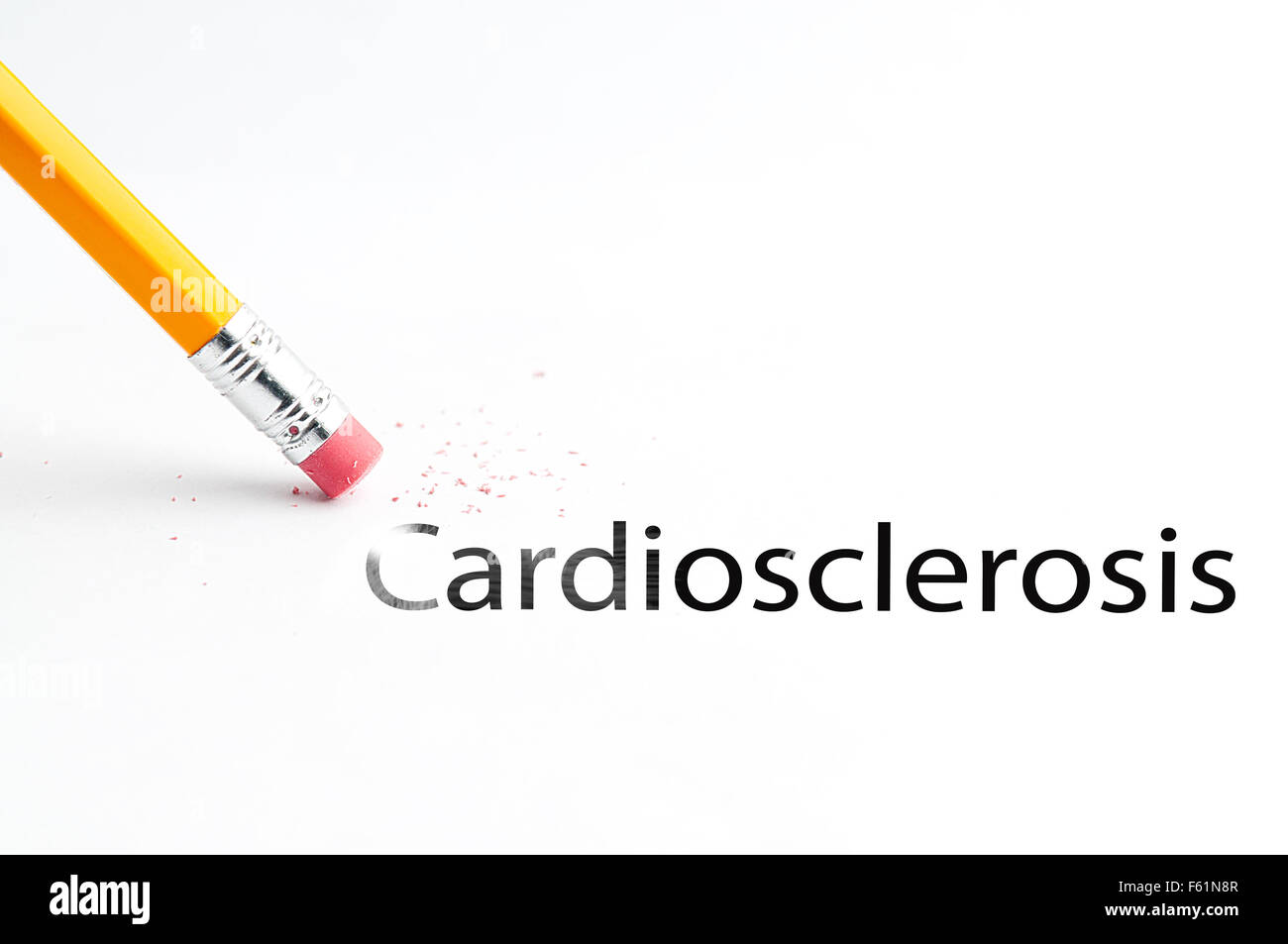 Cardiosclerosis pathology hi-res stock photography and images - Alamy