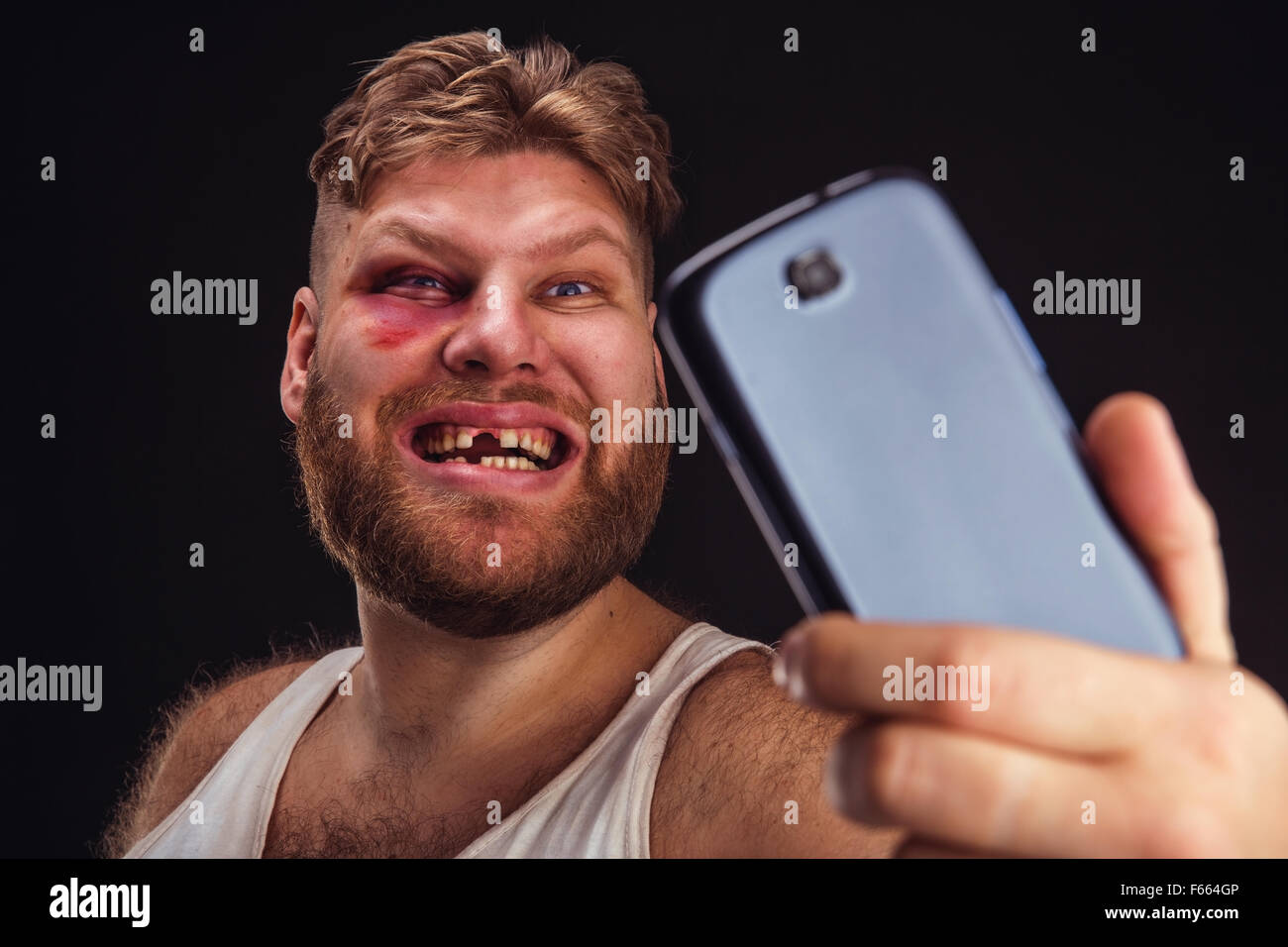 Man with bruise and without tooth takes selfie over black Stock Photo ...
