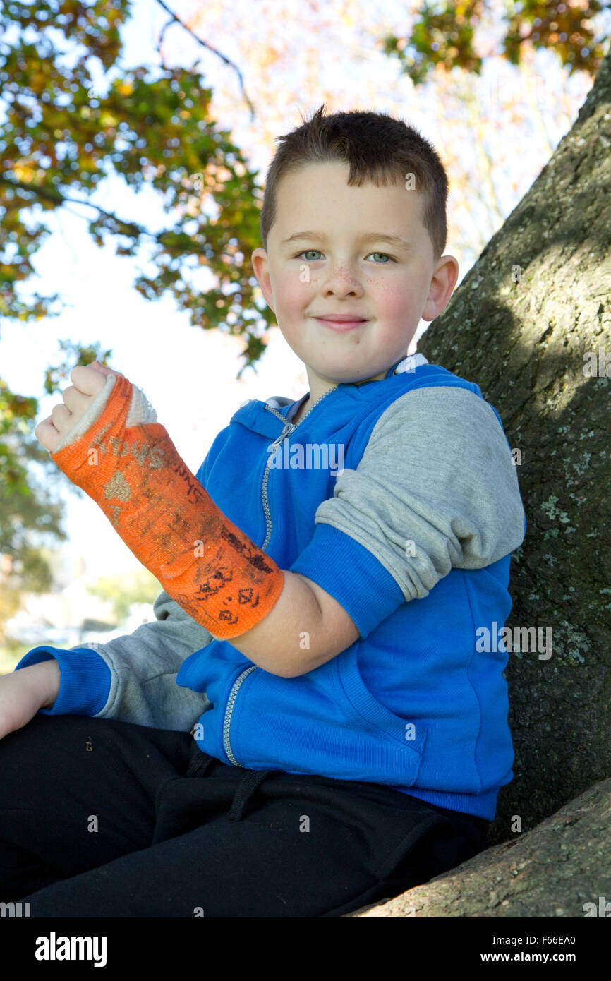 Boy with broken arm Stock Photo - Alamy